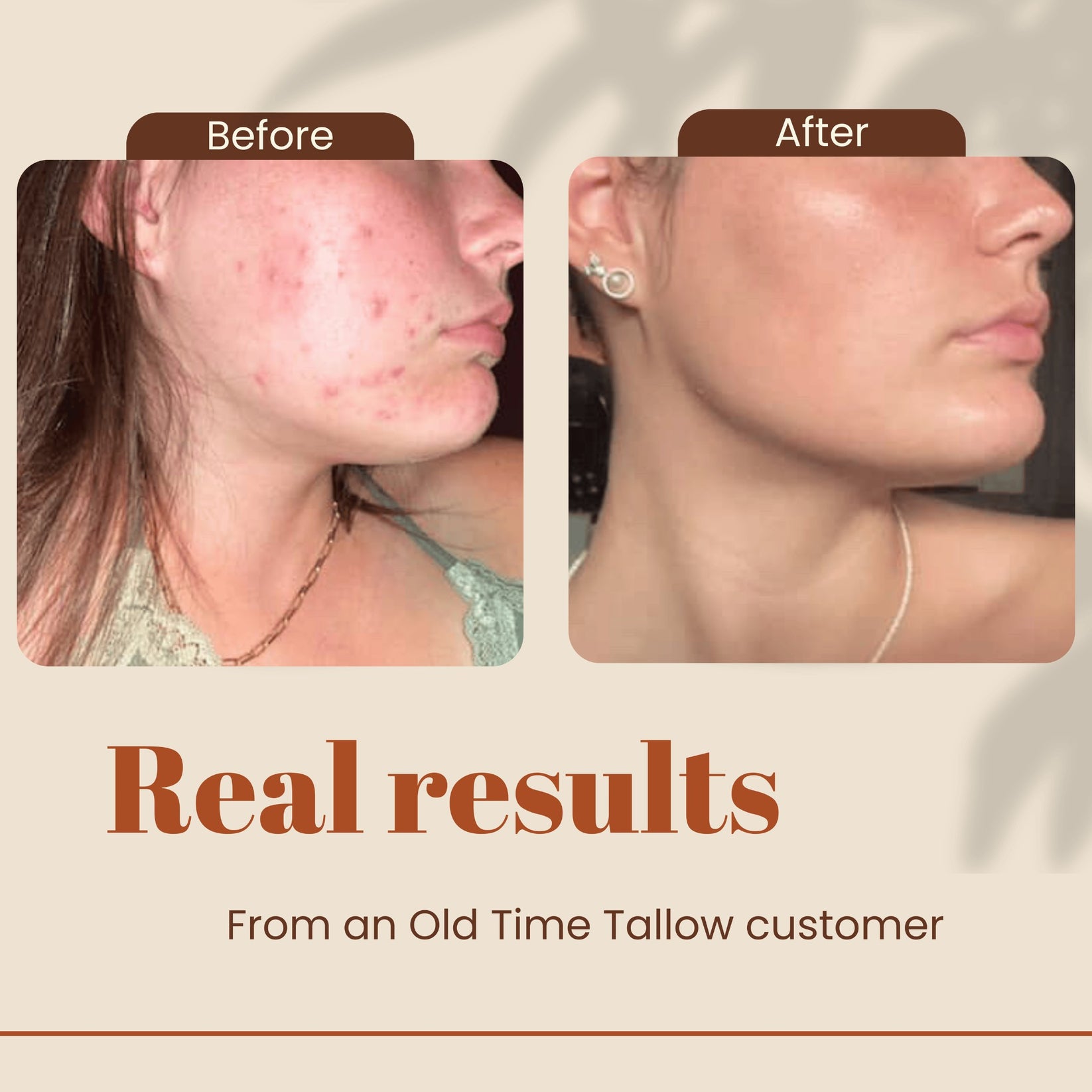 Organic Tallow Face Moisturizer — 100% Grass Fed — Made in the USA ...